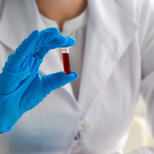 Respiratory Panels RSV, RPP | Rapid Test Laboratories